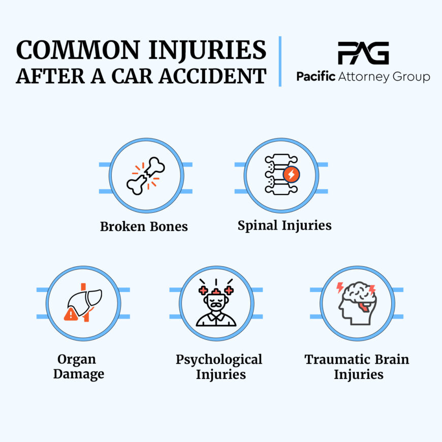 Motorcycle Accident Lawyer - Pacific Attorney Group